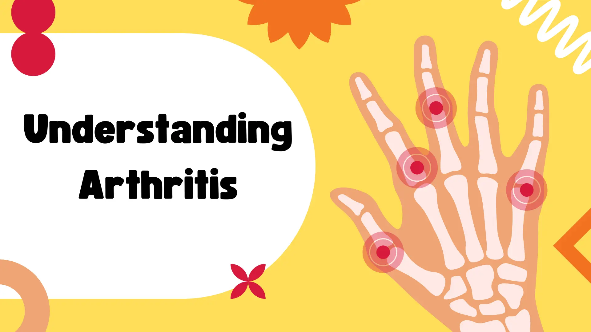 Understanding Arthritis: Types, Causes, and Orthopaedic Solutions